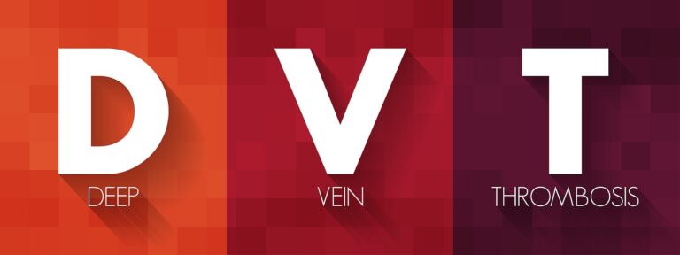 Deep Vein Thrombosis Treatment | Tampa Cardio Vein Clinic